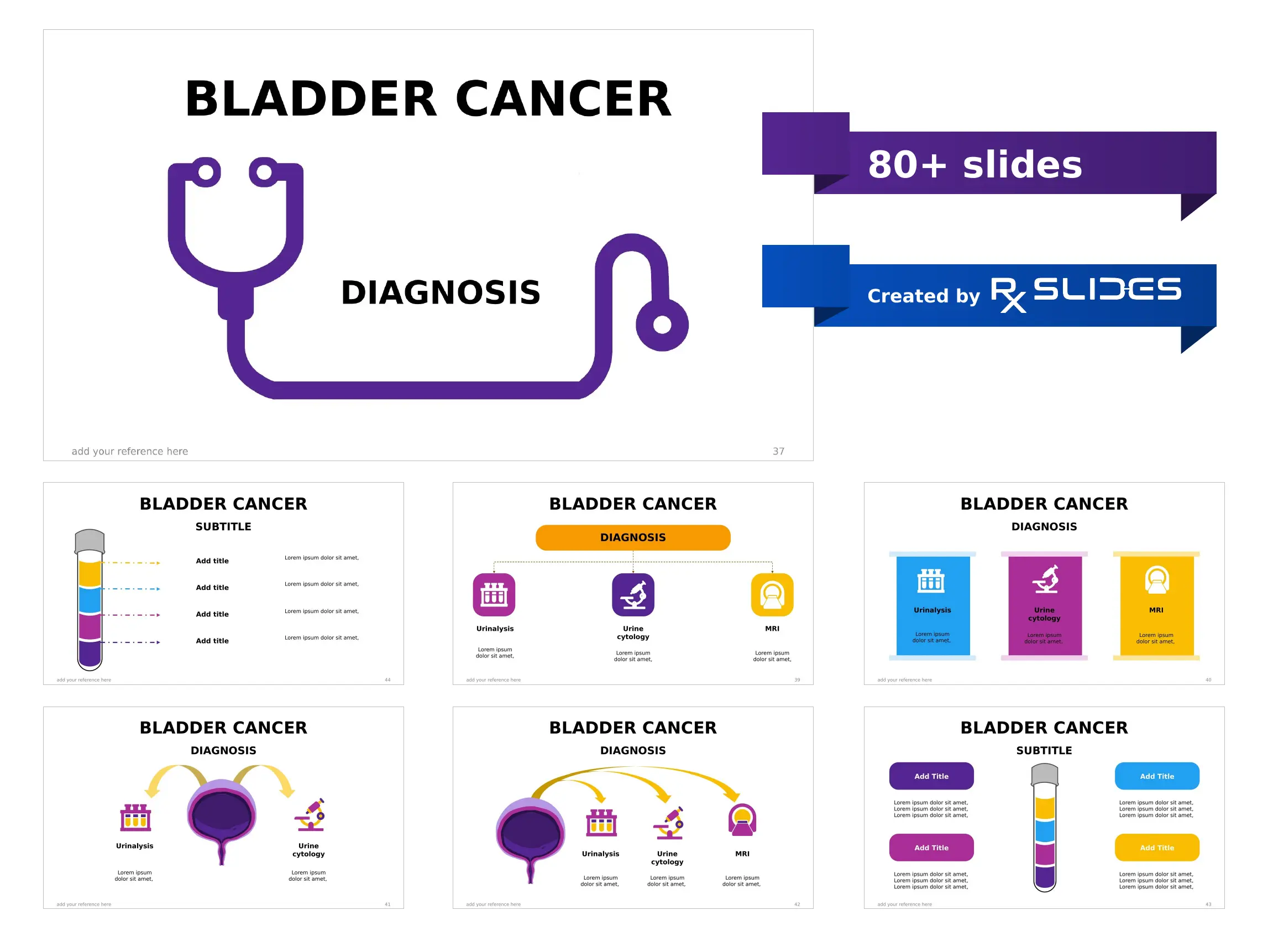 Download Bladder Cancer PowerPoint Template|RxSlides